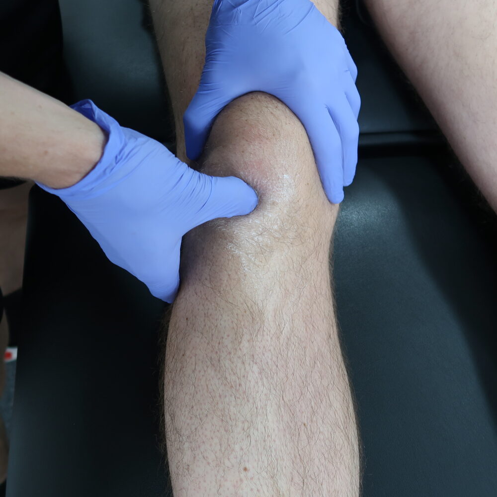 Orthotics Archives - Sharp Physiotherapy | Physiotherapy Clinic Based In Doncaster & Lincoln